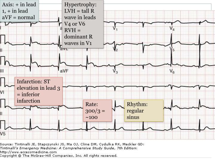 PPT - ECG, XR, Chest Pain, SOB PowerPoint Presentation - ID:1897378