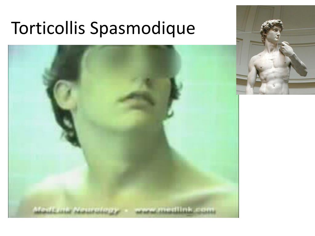 PPT - Maladie de Parkinson Troubles du Mouvement Pierre Bourque, MD ...