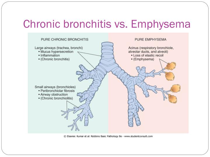 PPT - Chronic Obstructive Pulmonary Dise a ses (COPD) PowerPoint ...