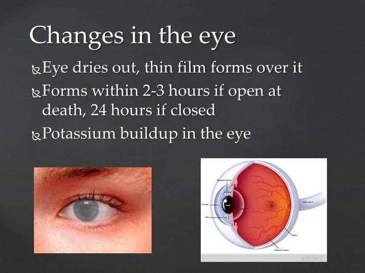 PPT - Aim: SWBAT describe the stages of decomposition of a corpse ...