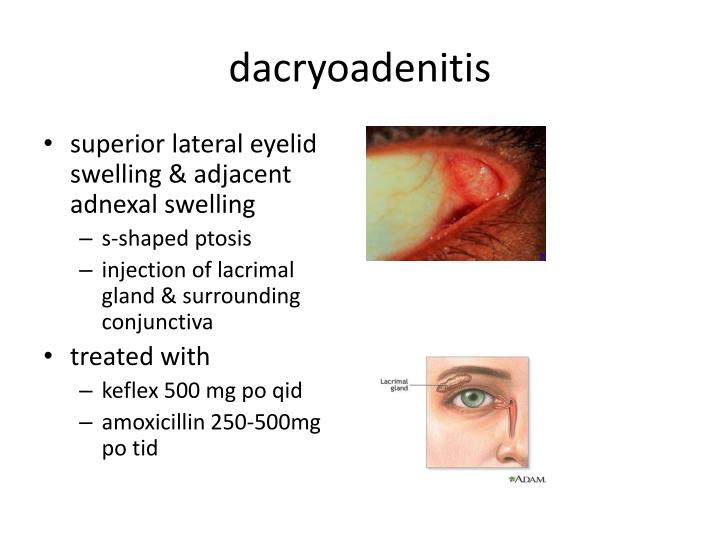 PPT - “Bull’s Eye” Maculopathy PowerPoint Presentation - ID:1898377
