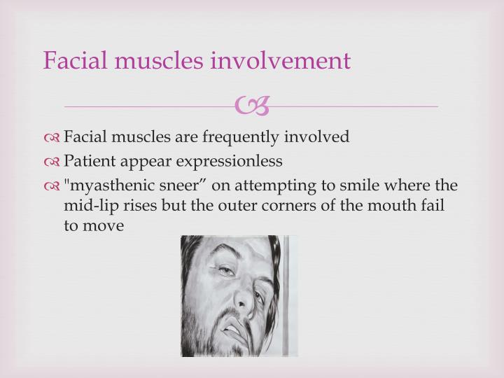 PPT - Neuromuscular Junction Disorders PowerPoint Presentation - ID:1898397