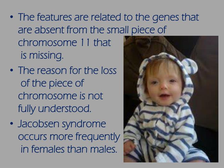 PPT - Jacobsen Syndrome PowerPoint Presentation - ID:1898441