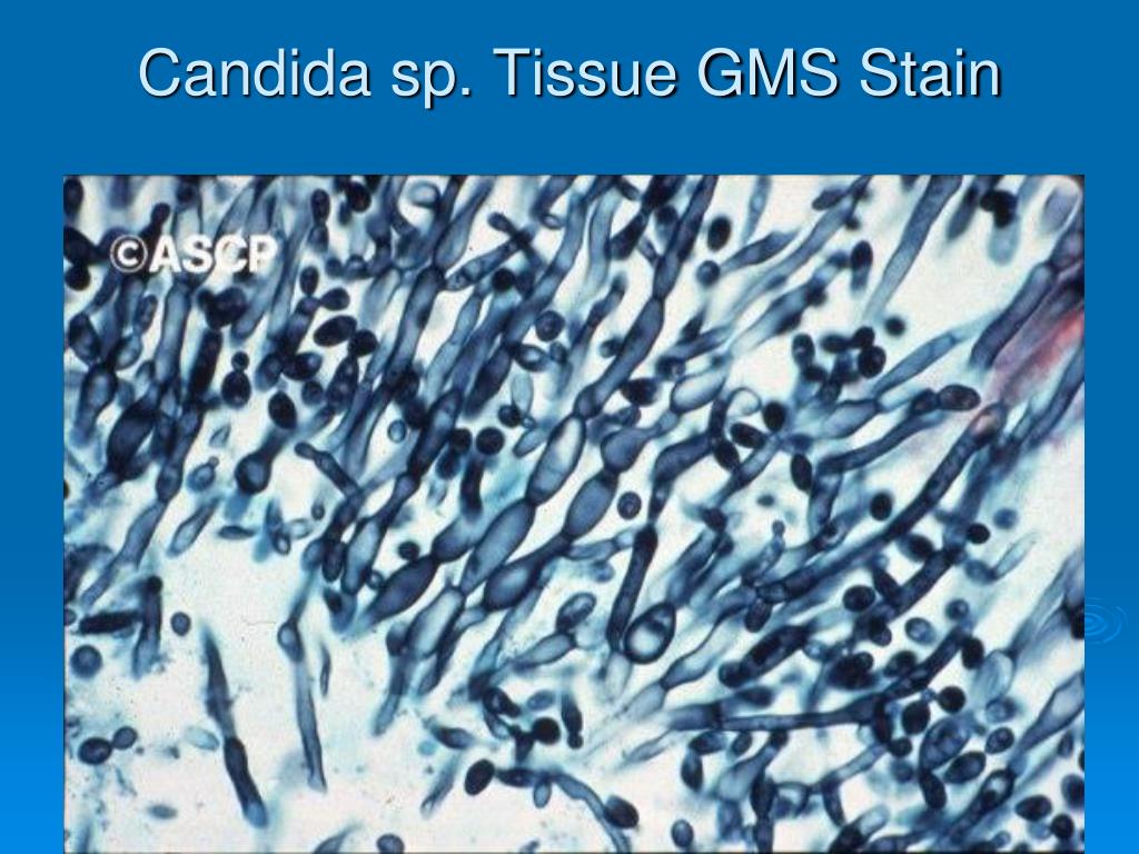 Ppt Mycology Powerpoint Presentation Free Download Id 1899063