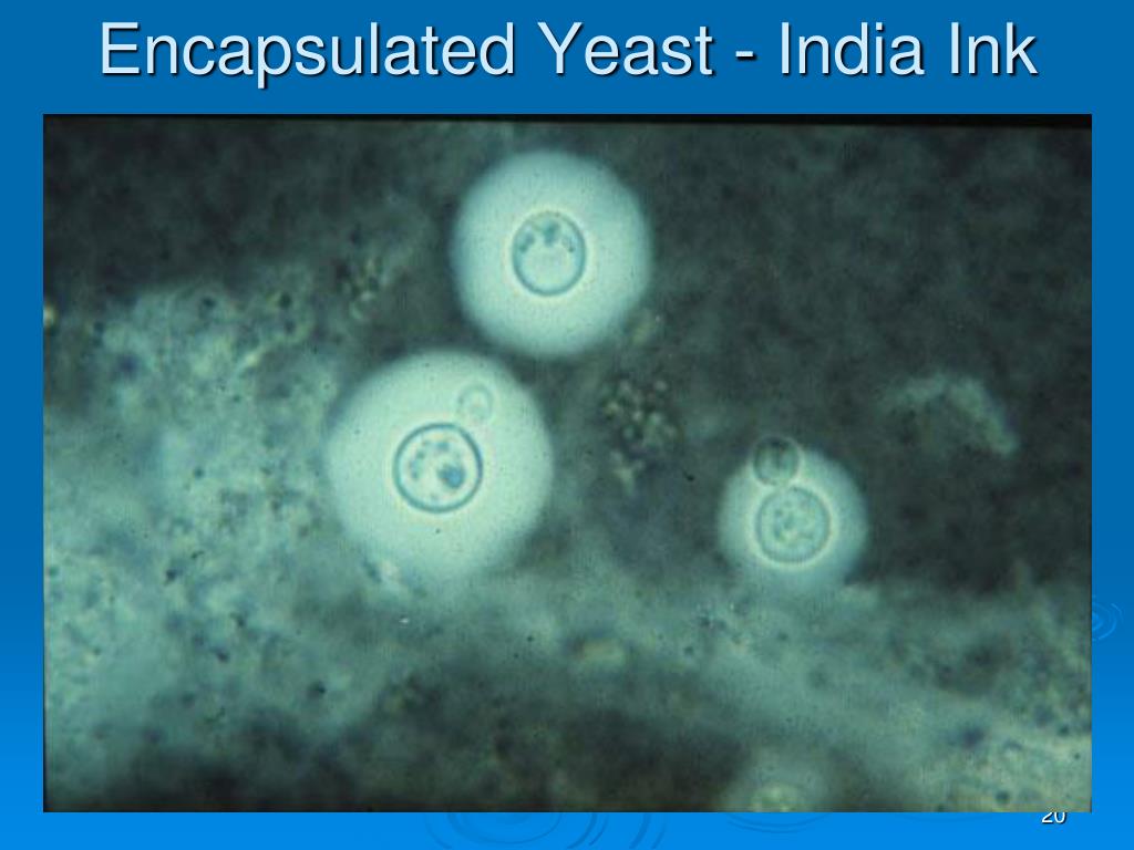 Ppt Mycology Powerpoint Presentation Free Download Id 1899063