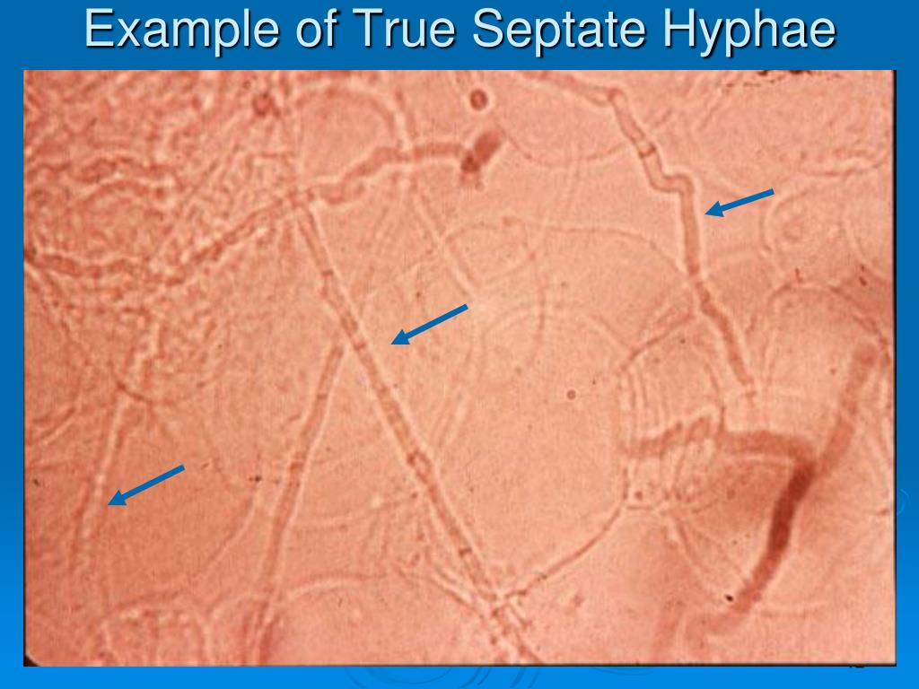 Ppt Mycology Powerpoint Presentation Free Download Id 1899063