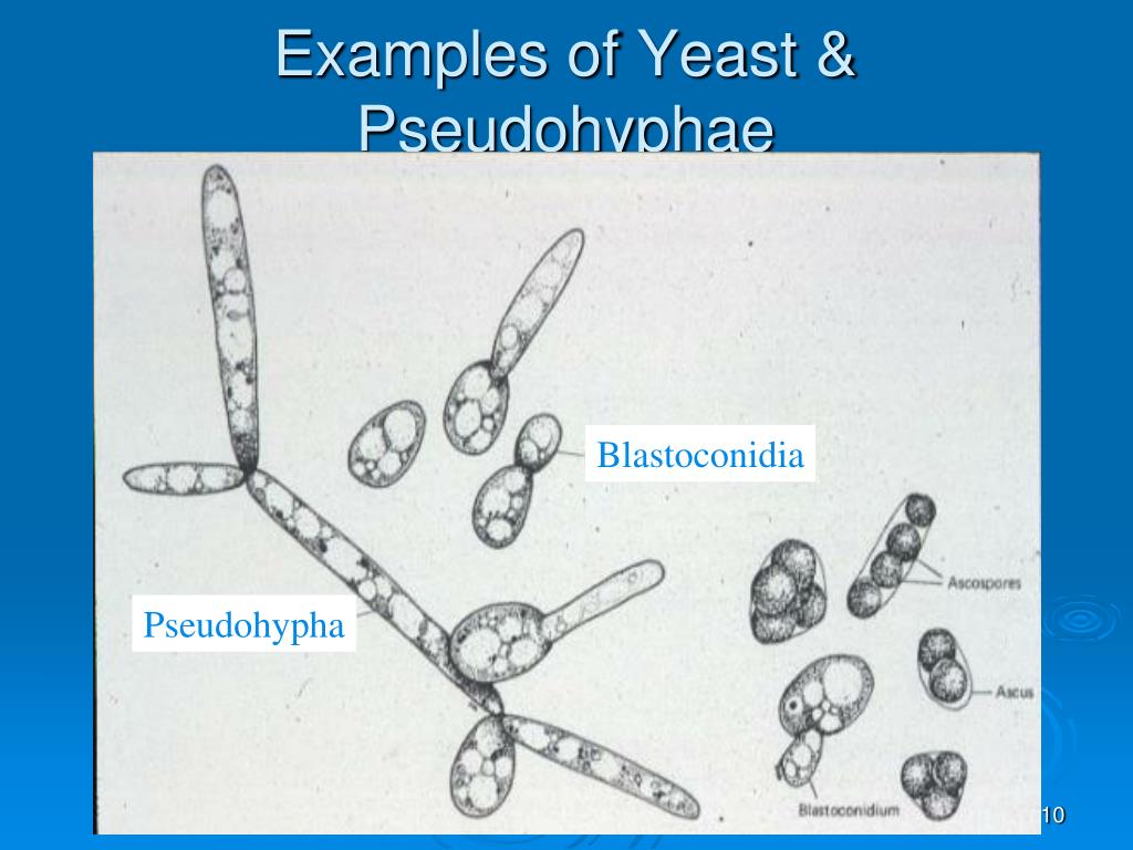 Ppt Mycology Powerpoint Presentation Free Download Id 1899063