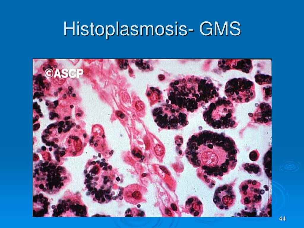 Ppt Mycology Powerpoint Presentation Free Download Id 1899063