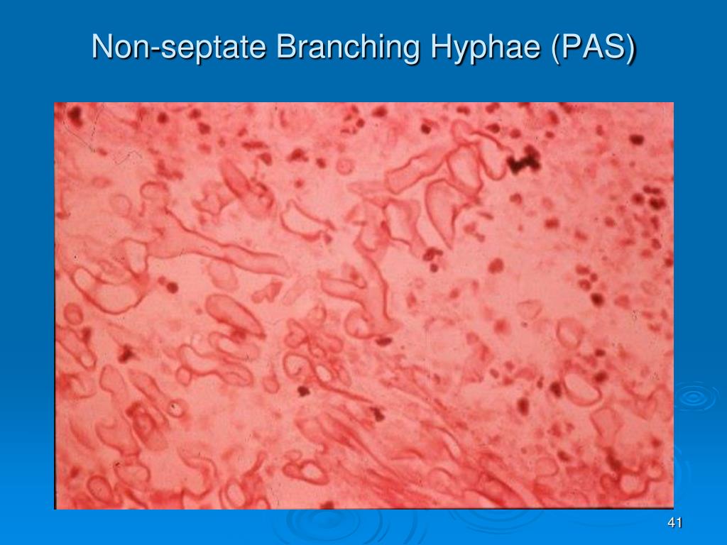 Ppt Mycology Powerpoint Presentation Free Download Id 1899063