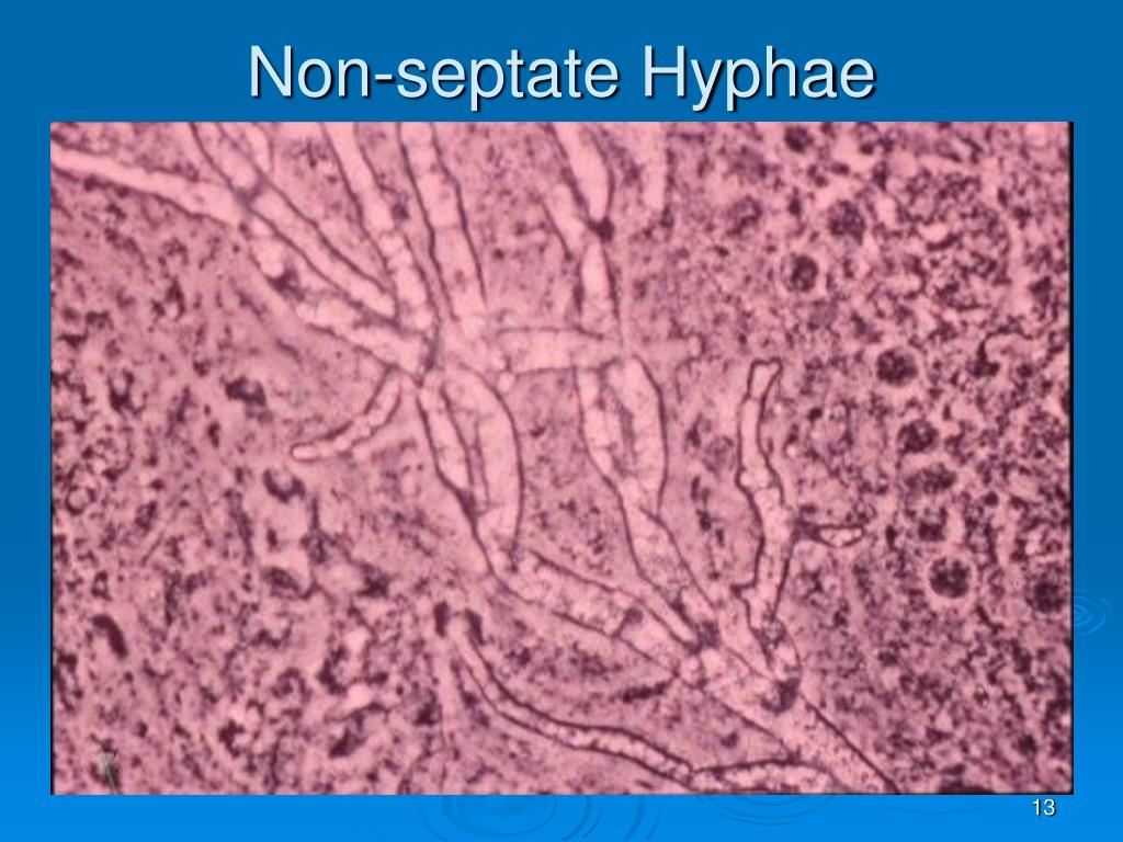Ppt Mycology Powerpoint Presentation Free Download Id 1899063