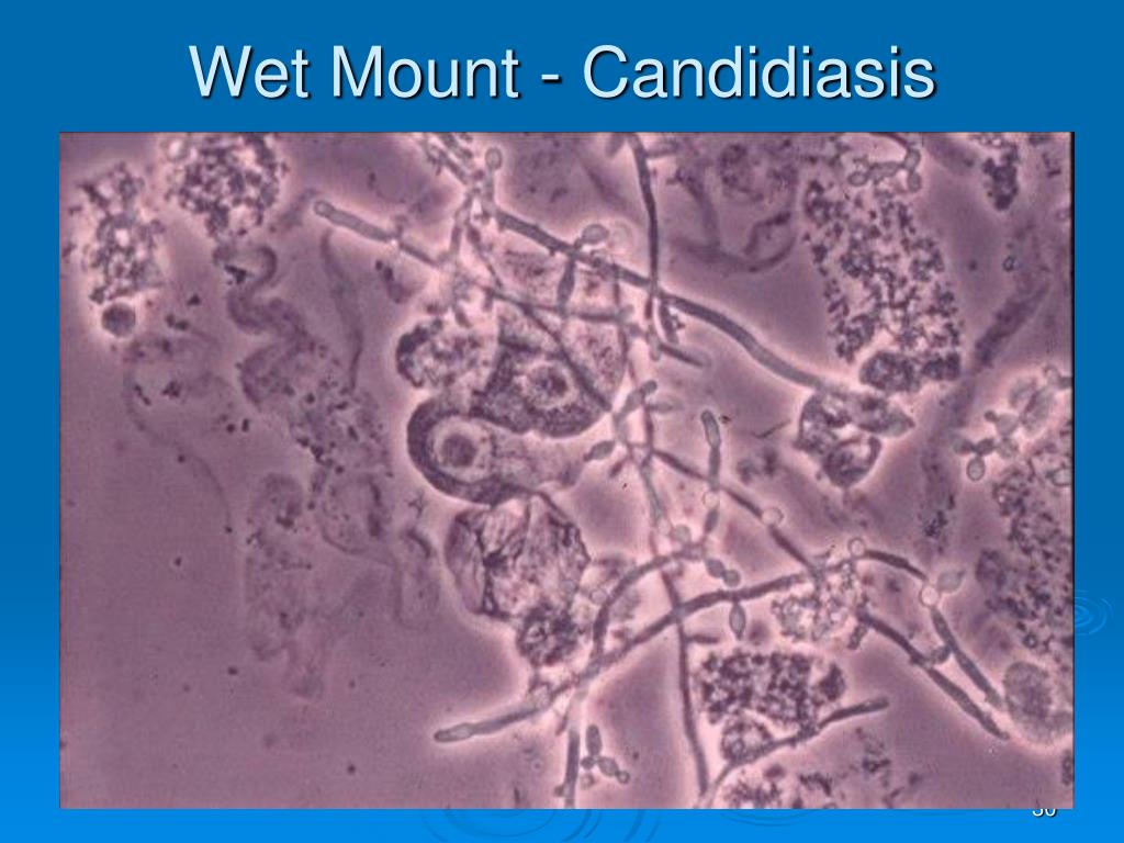 Ppt Mycology Powerpoint Presentation Free Download Id 1899063