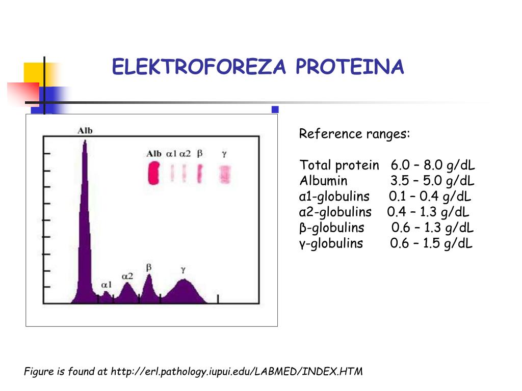 PPT - SEKUNDARNI POREMEČAJI METABOLIZMA PROTEINA PowerPoint ...
