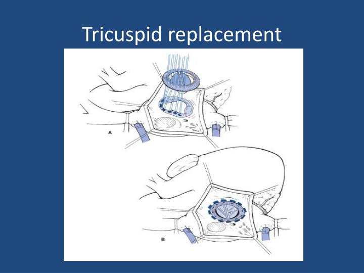 PPT - Tricuspid Valve Disease PowerPoint Presentation - ID:1902037