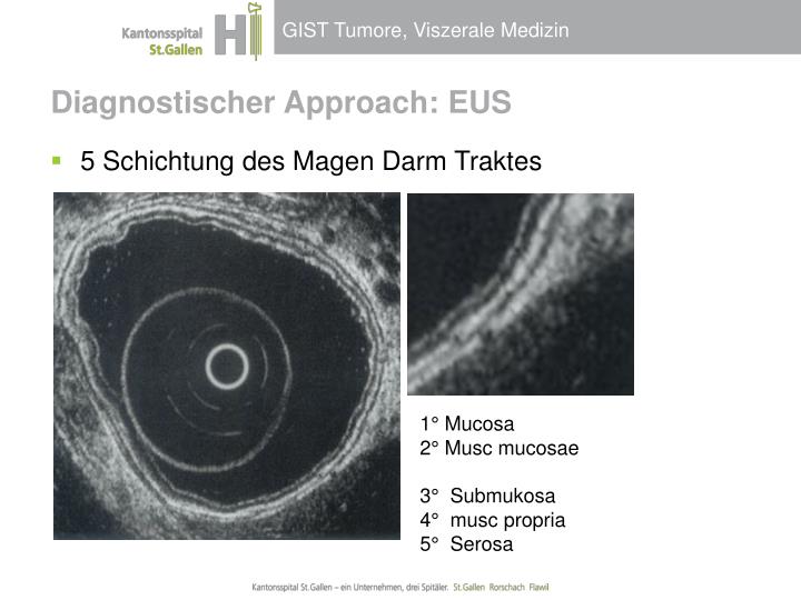 PPT - GIST-Tumore PowerPoint Presentation - ID:1902205