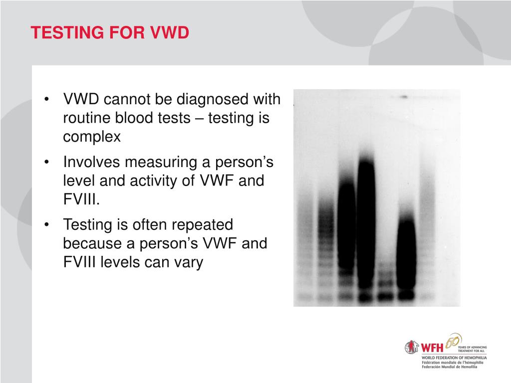PPT - Von willebrand disease PowerPoint Presentation, free download ...