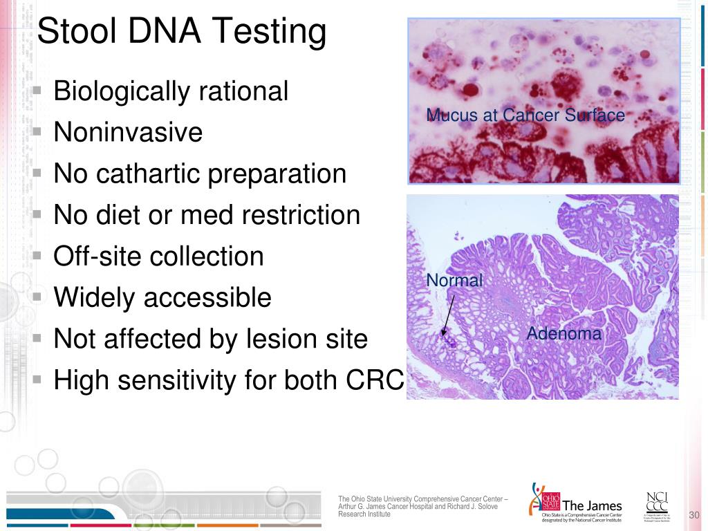 PPT - Advances in Colorectal Cancer: Genetics, Prevention and Progress ...