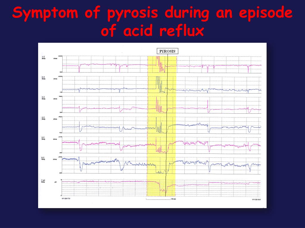 PPT - DIAGNOSTICA FUNZIONALE NERD SINTOMI ATIPICI PowerPoint ...