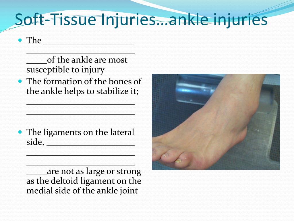 PPT - Injuries to the Lower Leg, Ankle, and Foot PowerPoint ...
