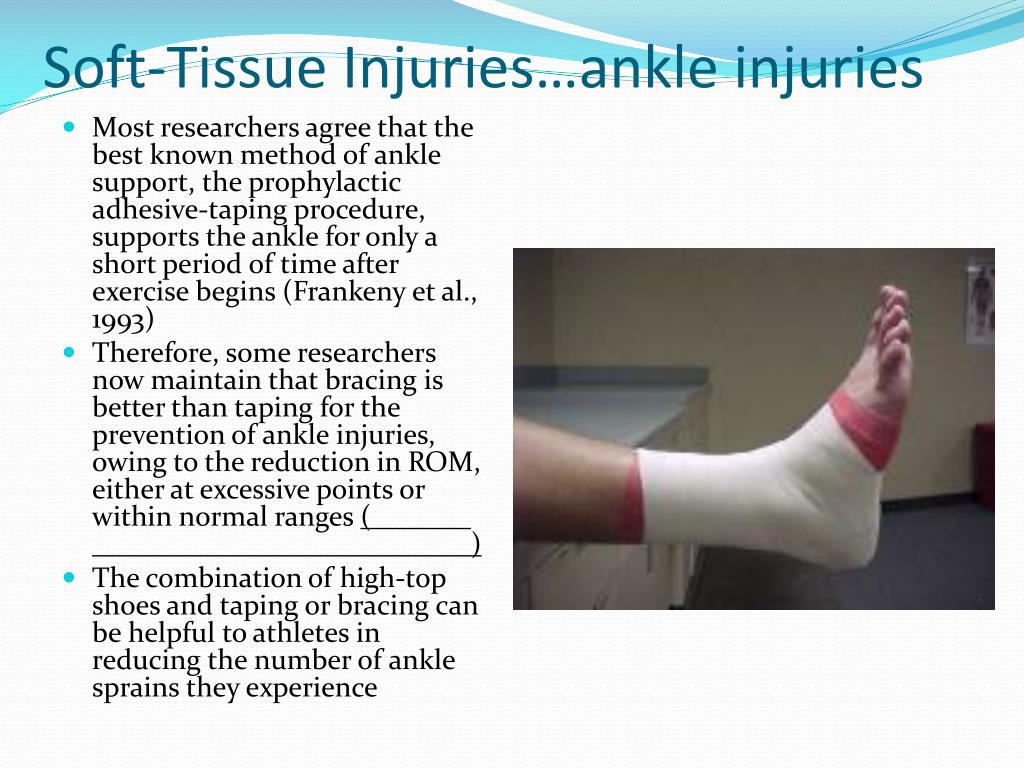 Ppt Injuries To The Lower Leg Ankle And Foot Powerpoint Presentation Id1904853