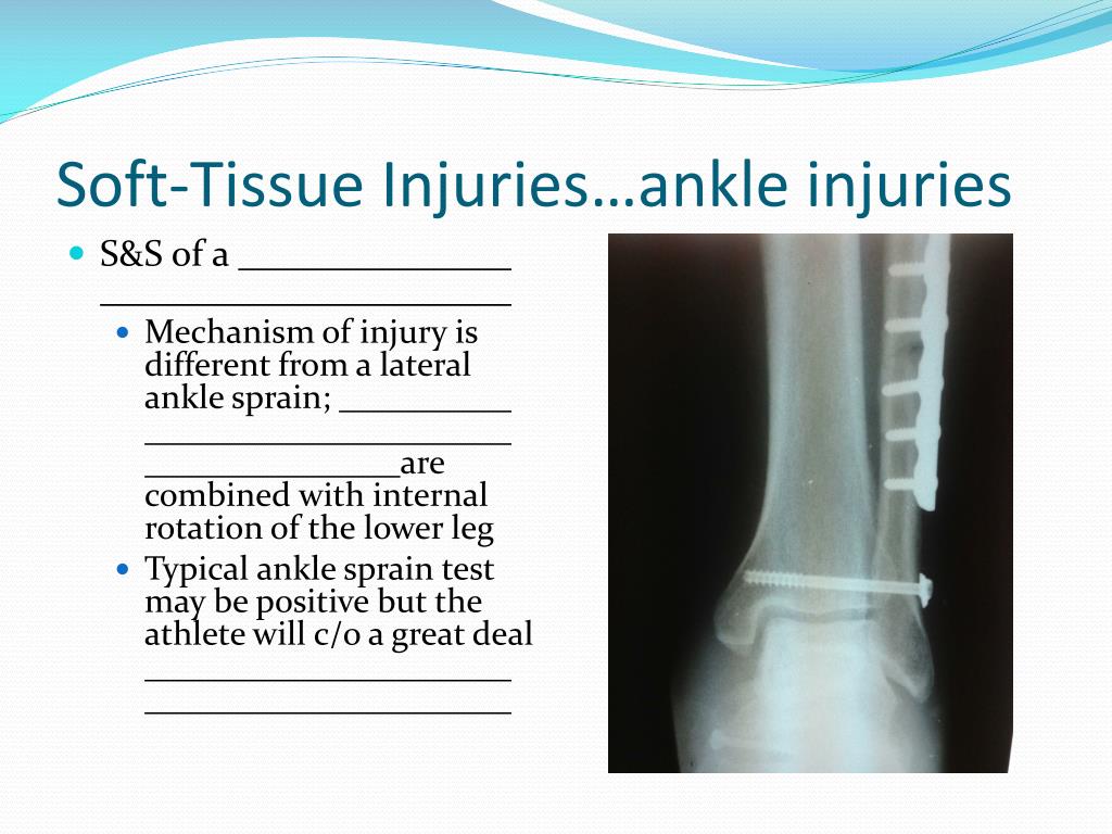 PPT - Injuries to the Lower Leg, Ankle, and Foot PowerPoint ...