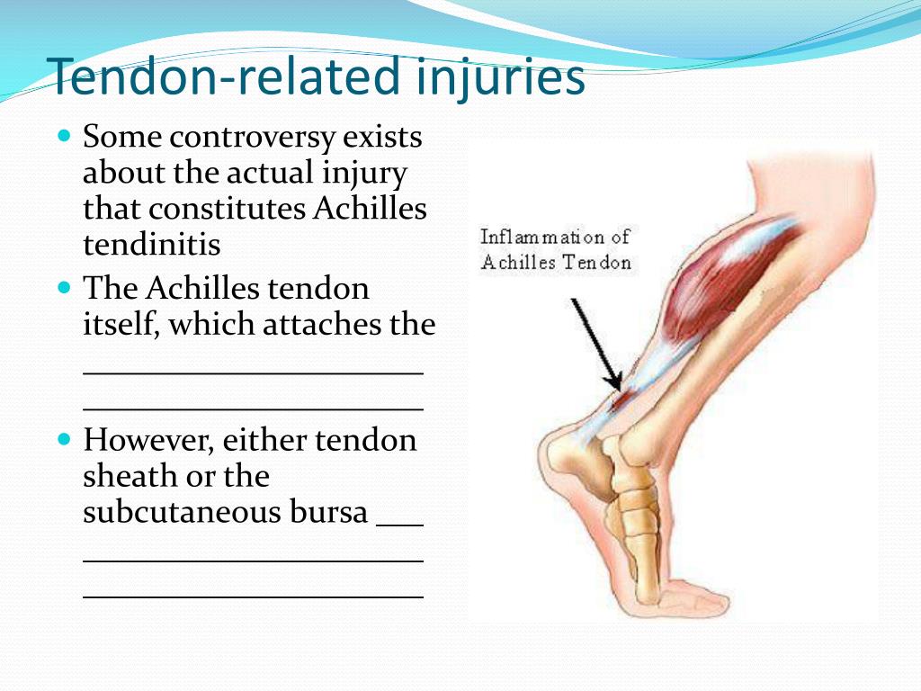 PPT - Injuries to the Lower Leg, Ankle, and Foot PowerPoint ...