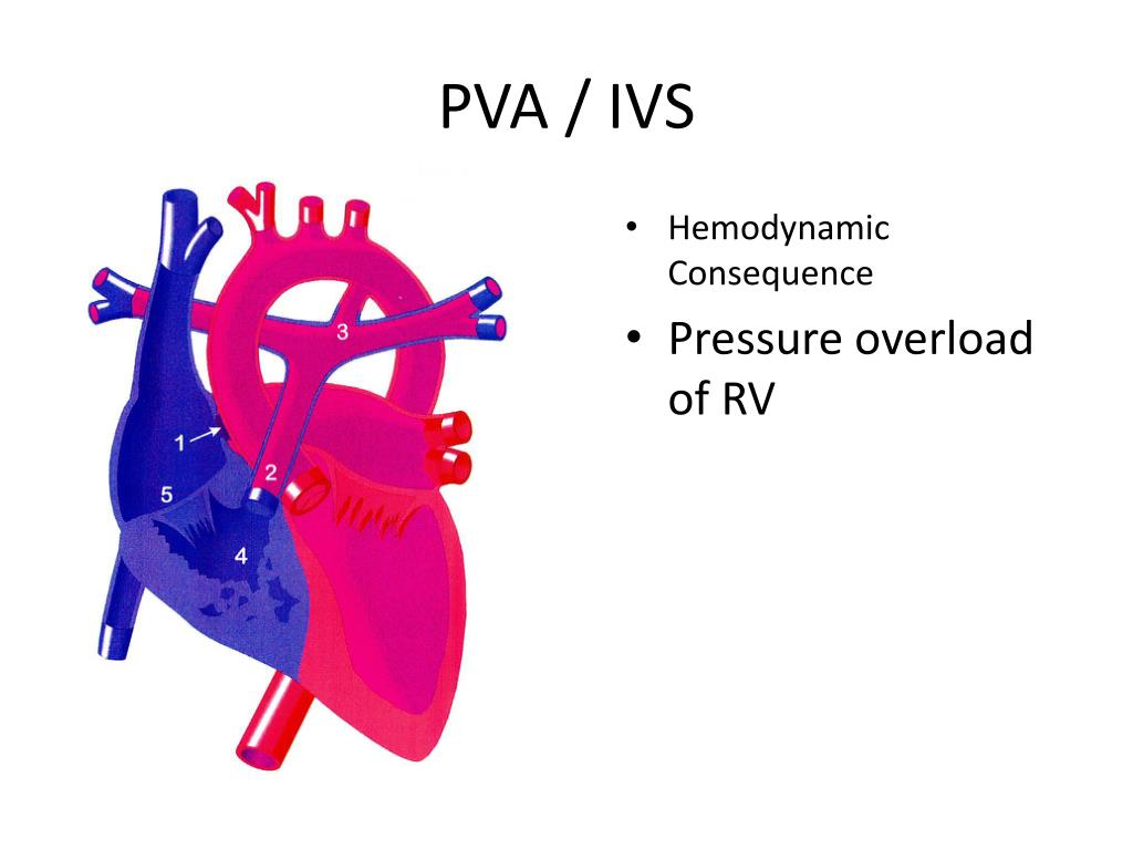 PPT - CARDIOVASCULAR CONFERENCE: Approach to a patient with cyanotic ...