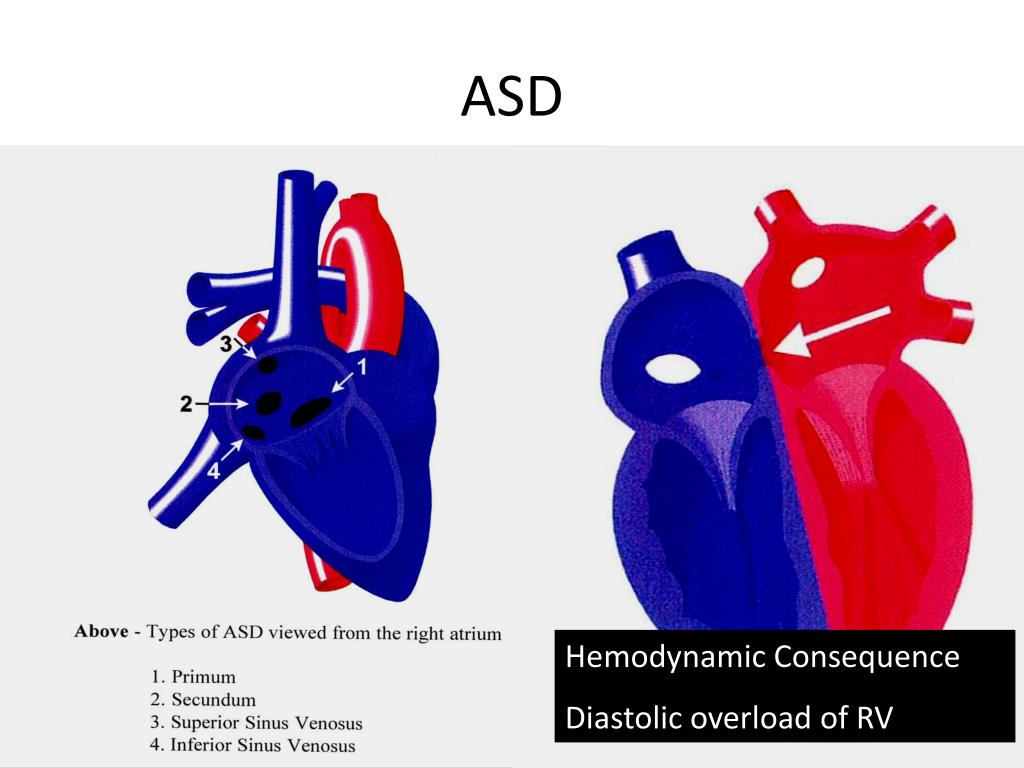 PPT - CARDIOVASCULAR CONFERENCE: Approach to a patient with cyanotic ...