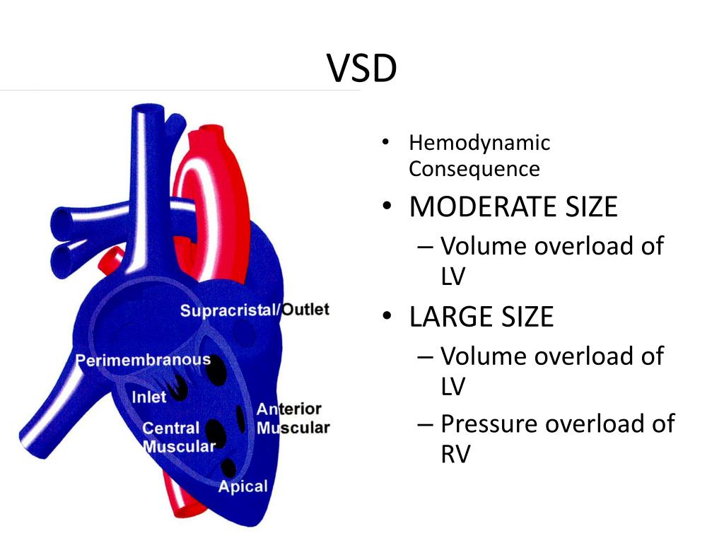 PPT - CARDIOVASCULAR CONFERENCE: Approach to a patient with cyanotic ...