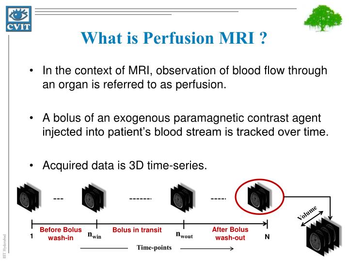 PPT - Patient-motion analysis in perfusion weighted MRi PowerPoint ...
