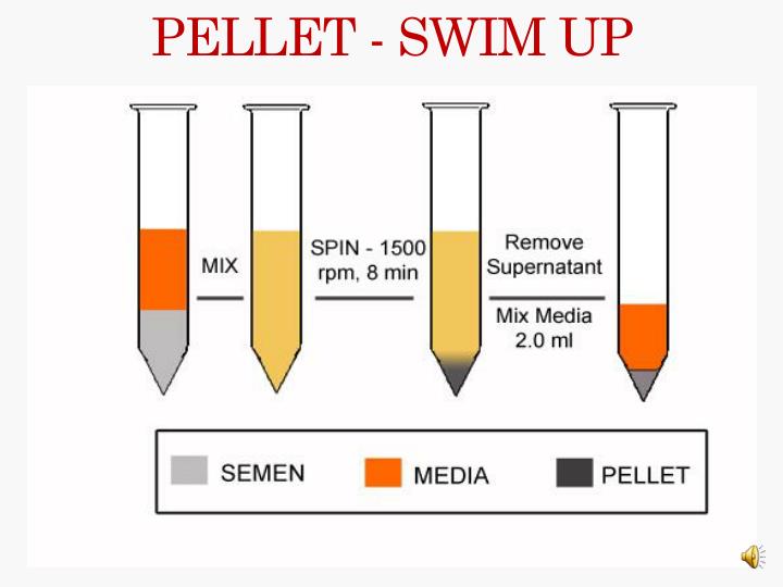 PPT - SEMEN PREPARATION for IUI PowerPoint Presentation - ID:1905204