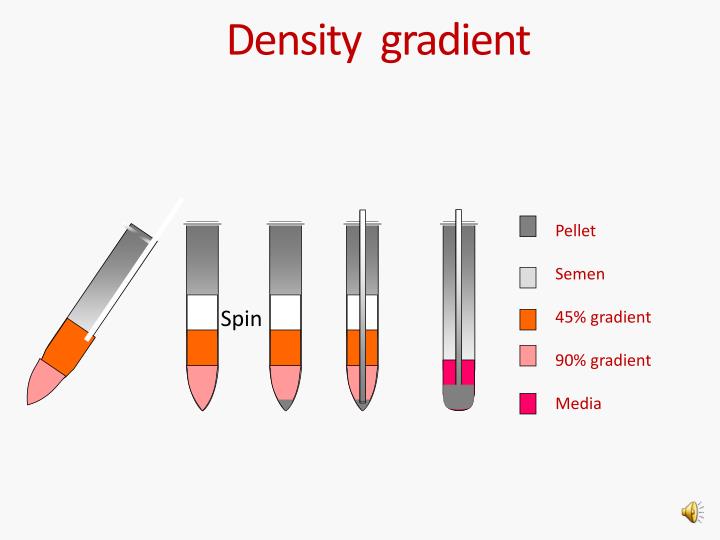 PPT - SEMEN PREPARATION for IUI PowerPoint Presentation - ID:1905204