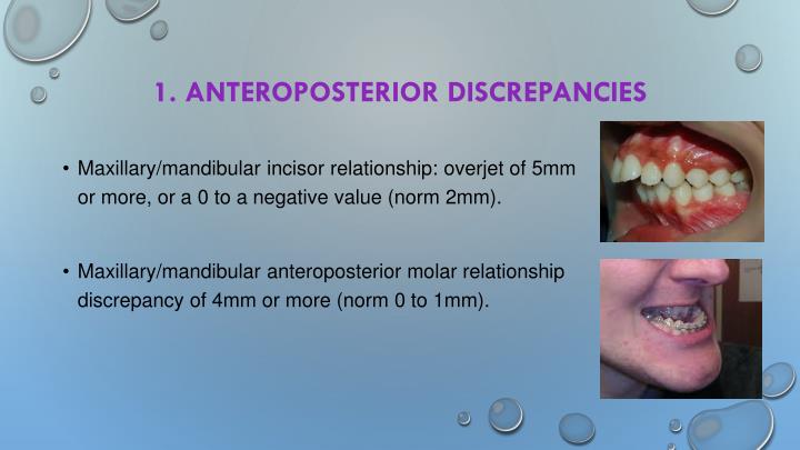 PPT - Orthodontic and Orthognathic Surgery PowerPoint Presentation - ID ...
