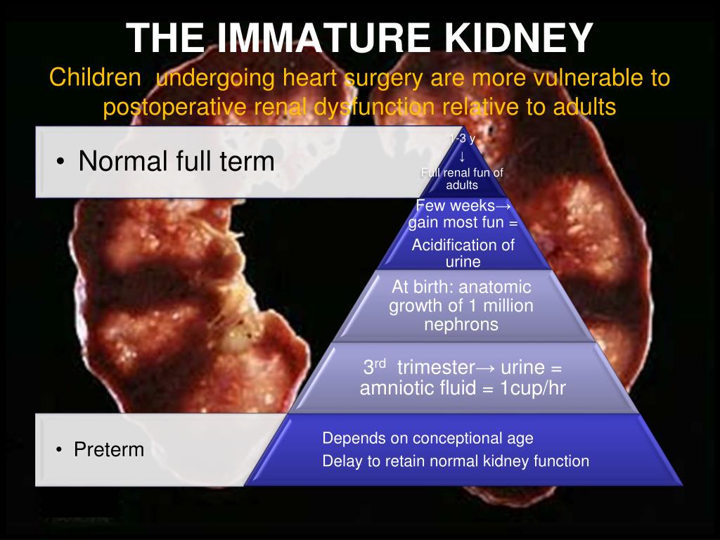 PPT - RENAL PROTECTION IN PEDIATRIC CARDIAC SURGERY PowerPoint ...