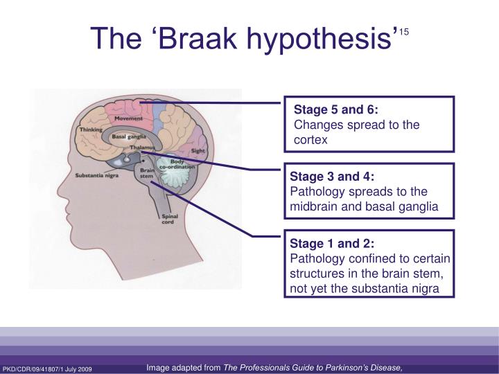 PPT - What is Parkinson’s? PowerPoint Presentation - ID:1910517