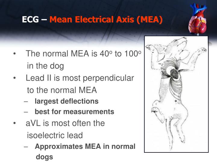 PPT - Electrocardiogram PowerPoint Presentation - ID:1910947