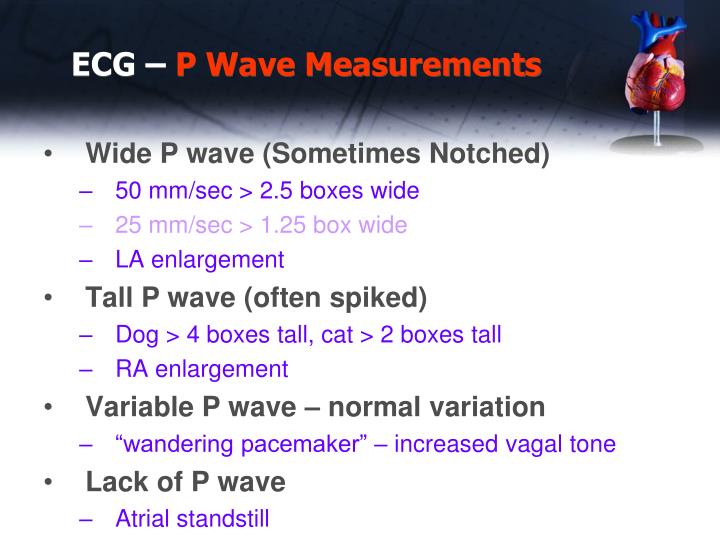 PPT - Electrocardiogram PowerPoint Presentation - ID:1910947