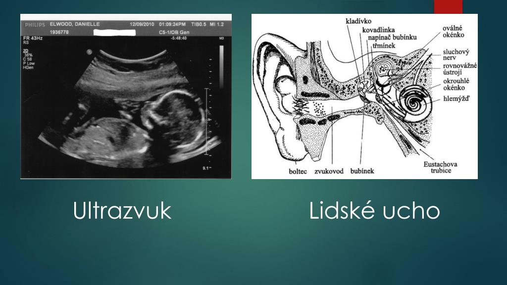 PPT - Akustika - zvuk, hlasitost, intenzita PowerPoint Presentation ...