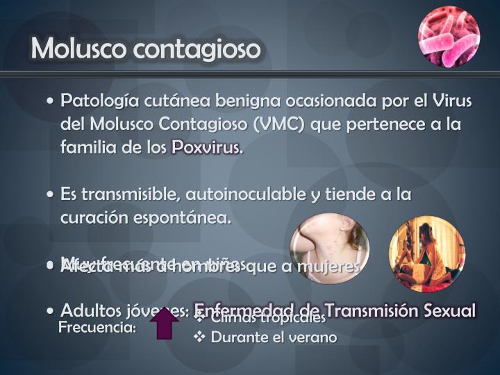 PPT - Molusco contagioso PowerPoint Presentation - ID:1912587