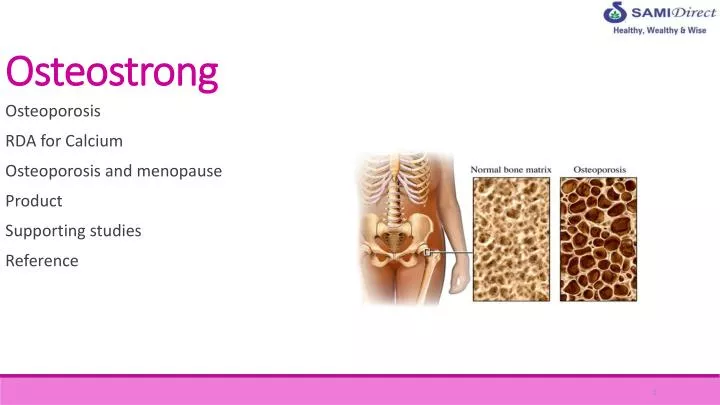 PPT - Osteostrong PowerPoint Presentation, free download - ID:1913836