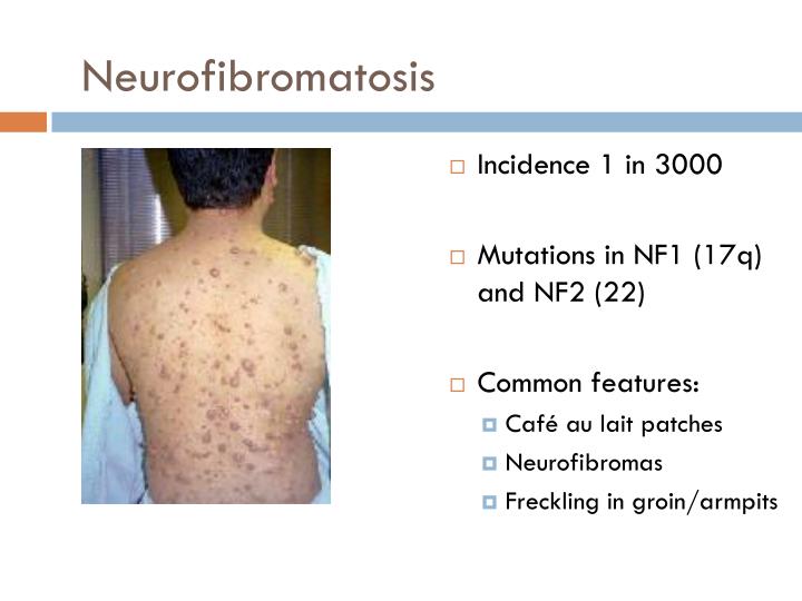 PPT - Genetic Conditions and Birth Defects PowerPoint Presentation - ID ...
