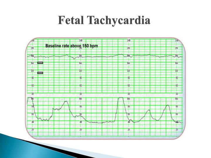 PPT - ANTENATAL ASSESSMENT OF FETAL WELLBIENG PowerPoint Presentation ...