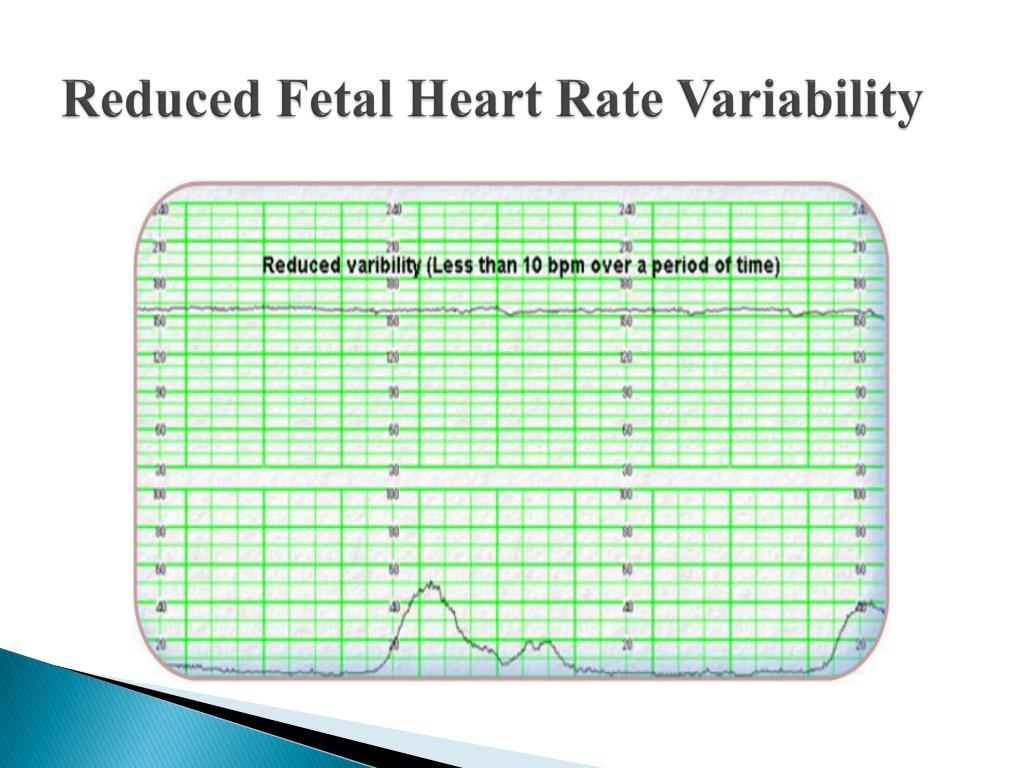 PPT - ANTENATAL ASSESSMENT OF FETAL WELLBIENG PowerPoint Presentation ...