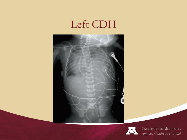 PPT - Neonatal Physiology PowerPoint Presentation - ID:1914819