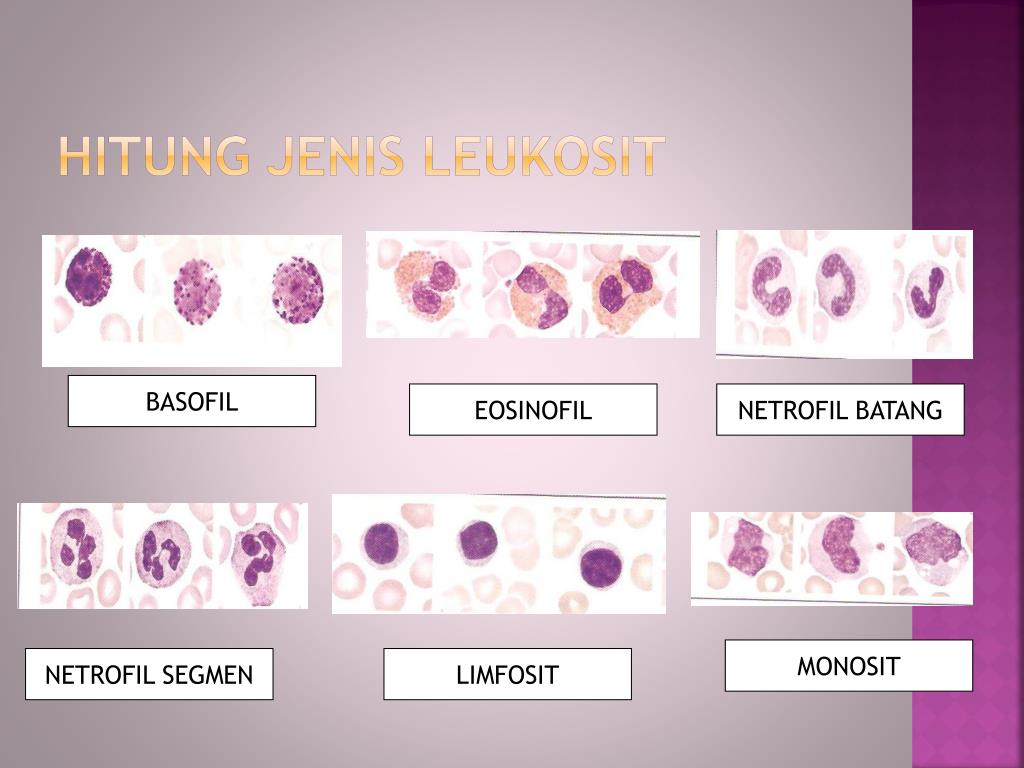 PPT - DIAGNOSIS HEMATOSEROLOGIS PADA INFEKSI PowerPoint Presentation ...