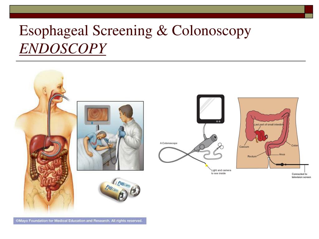 PPT - All About Poop scatology ( skuh-TOL-uh-jee ) noun : the ...