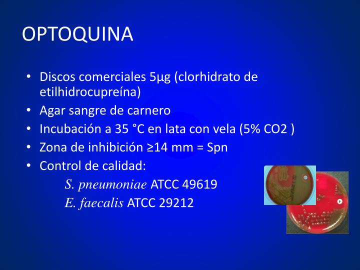 PPT - Meningitis bacteriana PowerPoint Presentation - ID:1917758