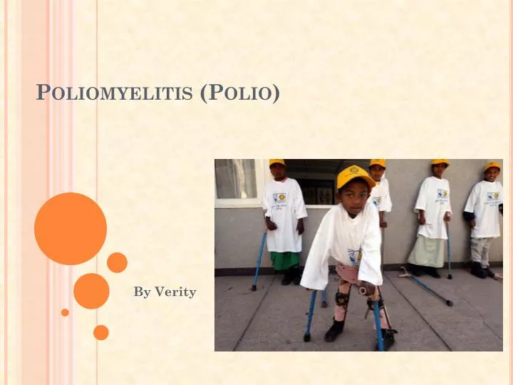 PPT - Poliomyelitis (Polio) PowerPoint Presentation, free download - ID ...