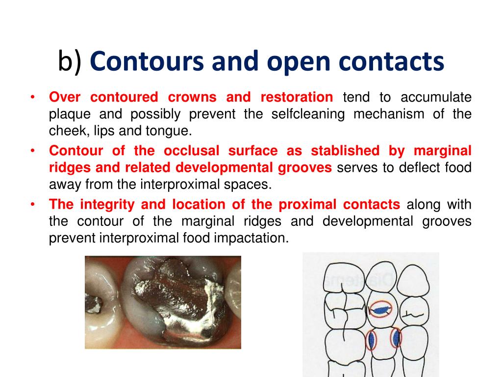 PPT - Plaque control for the prevention of oral diseases PowerPoint ...