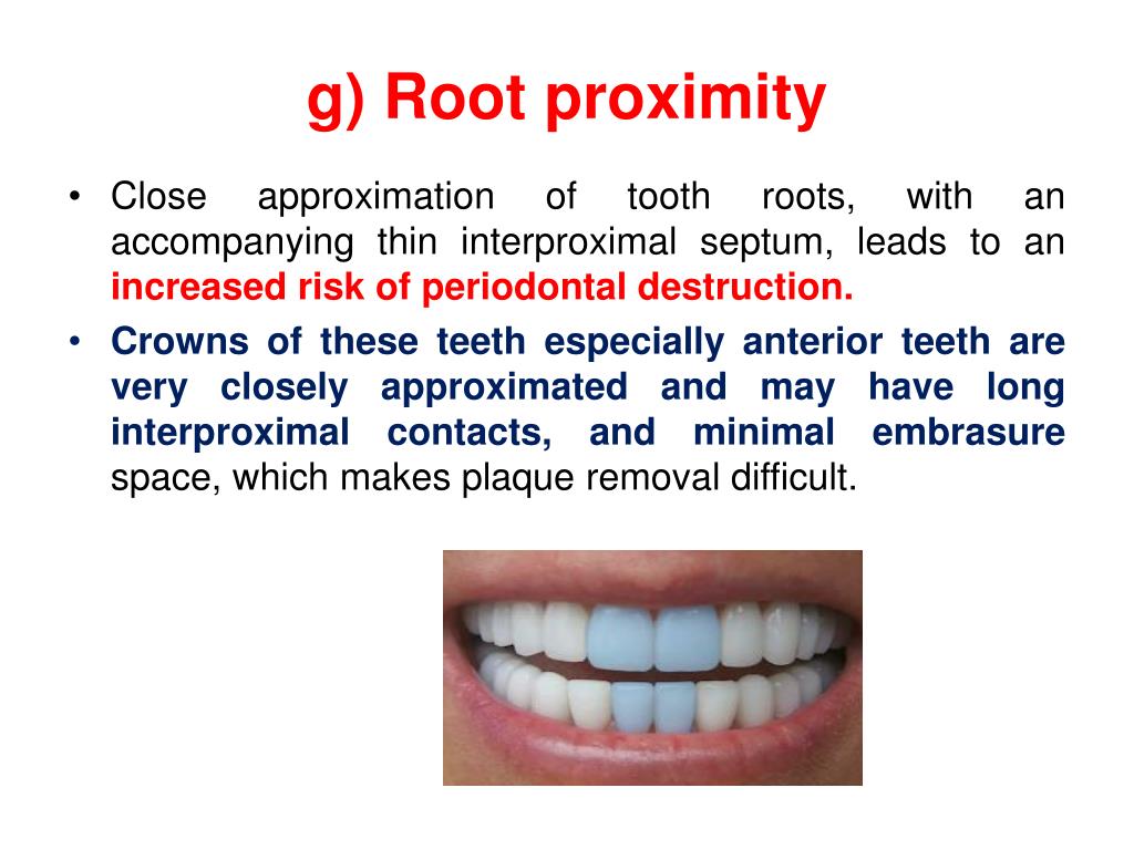 PPT - Plaque control for the prevention of oral diseases PowerPoint ...