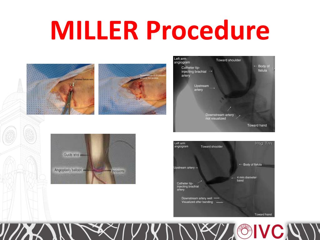 PPT - M Mazen Hachem *, MD, PhD, FACS., M Bosaeed * and M Wakka ...